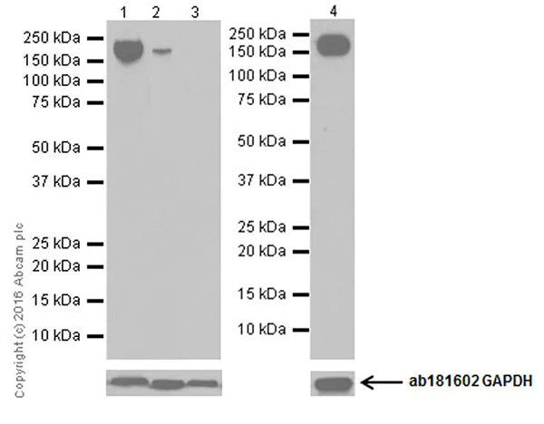 Anti-CD11b antibody [EPR19387] (ab184308) | Abcam