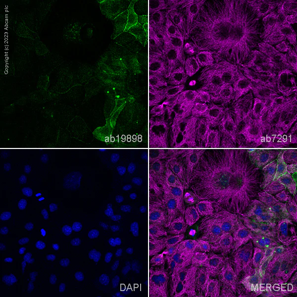 Anti-CD133 antibody - stem cell marker (ab19898) | Abcam