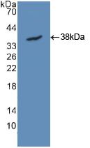 Anti-CD147 antibody (ab232991) | Abcam