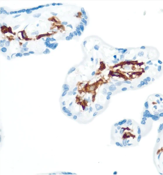 Anti-CD16 antibody [SP175] (ab183354) | Abcam