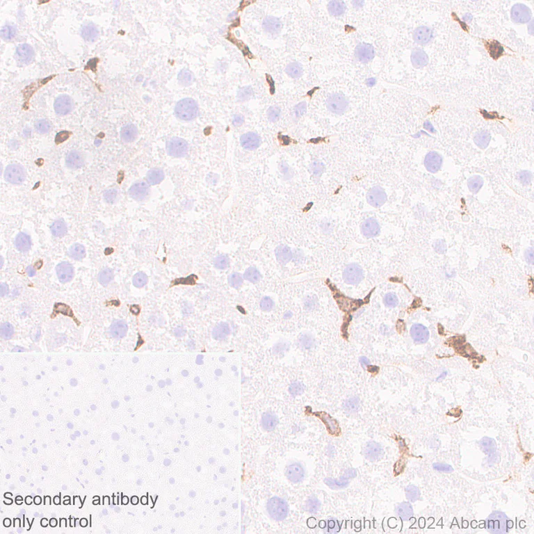 Anti-CD163 antibody [RM1114] (ab316218) | Abcam