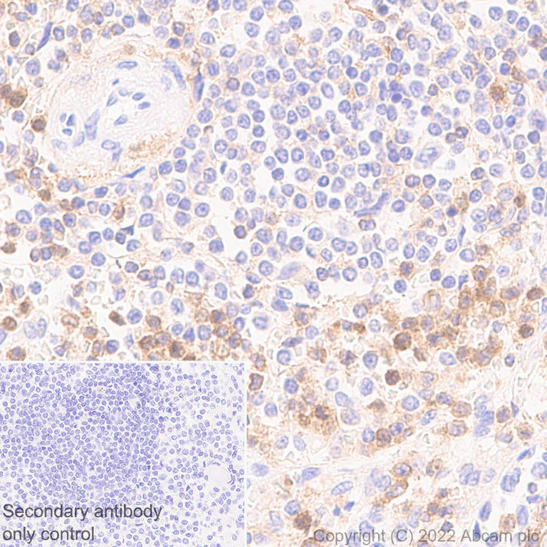 Anti-CD18 antibody [EPR26929-26] (ab307406) | Abcam