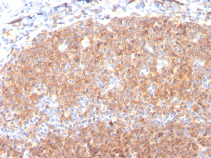 Anti-CD19 antibody [CD19/3117] (ab270715) | Abcam