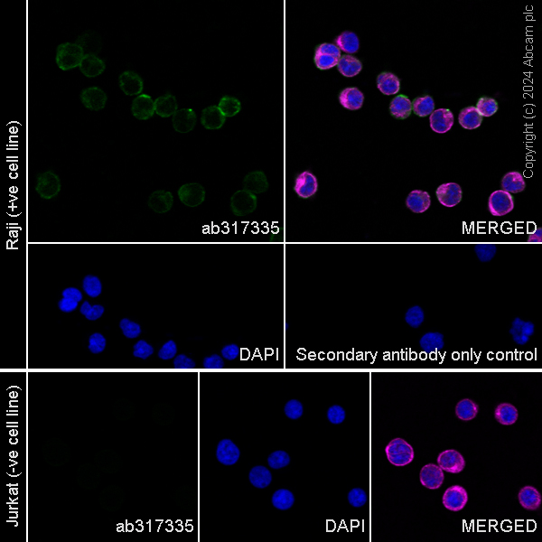 Anti-CD19 antibody [RM1166] (ab317335) | Abcam