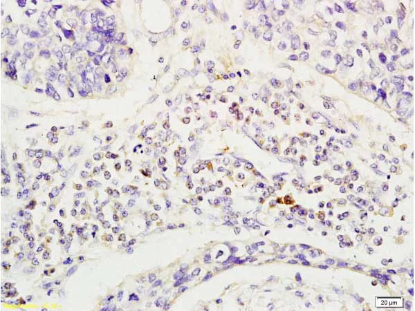 Anti-CD19 (phospho Y531) antibody (ab203615) | Abcam