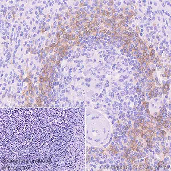Anti-CD1c antibody [EPR23189-196] (ab246520) | Abcam