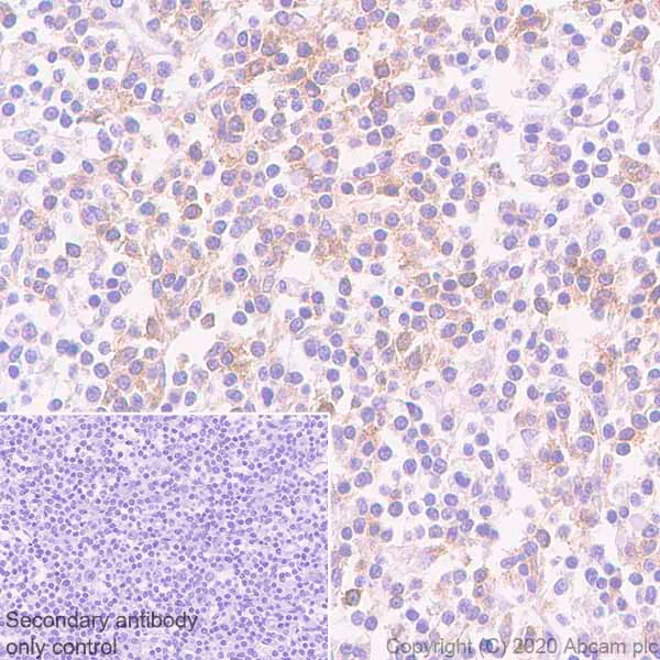 Anti-CD1c antibody [EPR23189-196] (ab246520) | Abcam