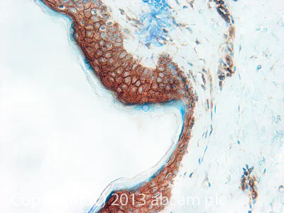 Anti-CD1d antibody [NOR3.2 (NOR3.2/13.17)] (ab11076) | Abcam