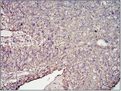 Anti-CD276 antibody [6A1] (ab105922) | Abcam