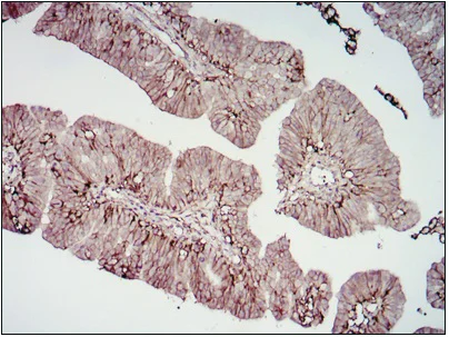 Anti-CD276 antibody [6A1] (ab105922) | Abcam