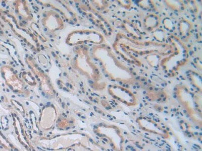 Anti-CD276 antibody (ab232791) | Abcam