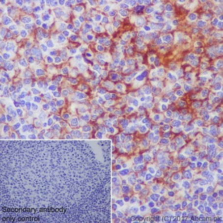 Anti-CD276 antibody [EPR20115] - BSA and Azide free (ab227577) | Abcam