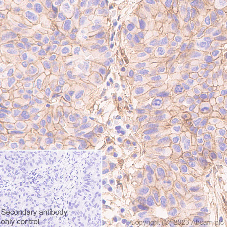 Anti-CD276 antibody [EPR27429-173] (ab313380) | Abcam
