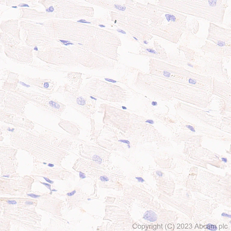 Anti-CD276 antibody [EPR27429-173] (ab313380) | Abcam