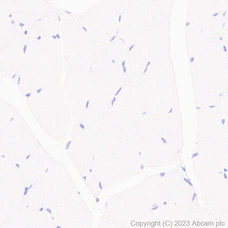 Anti-CD276 antibody [EPR27429-173] (ab313380) | Abcam