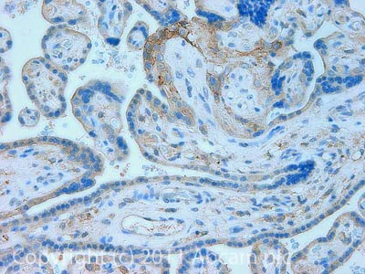 Anti-CD276 antibody [MM0104-20J12] (ab89133) | Abcam