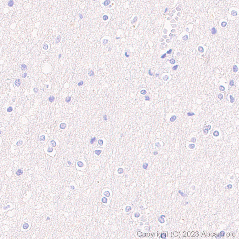 CD3 epsilon抗体[LE-CD3 #3/4] (ab313799)| Abcam中文官网