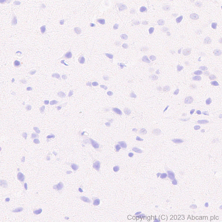 Anti-CD3 epsilon antibody [LE-CD3 #3/4] (ab313799) | Abcam