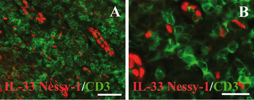Anti-CD3 epsilon antibody [SP7] 20 ul size (ab16669) | Abcam