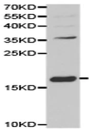 Anti-CD3 zeta antibody (ab190728) | Abcam