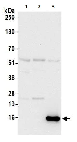 Anti-CD3 zeta antibody (ab226263) | Abcam