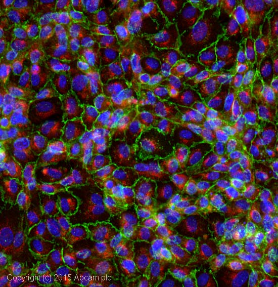Anti-CD31 antibody (ab32457) | Abcam