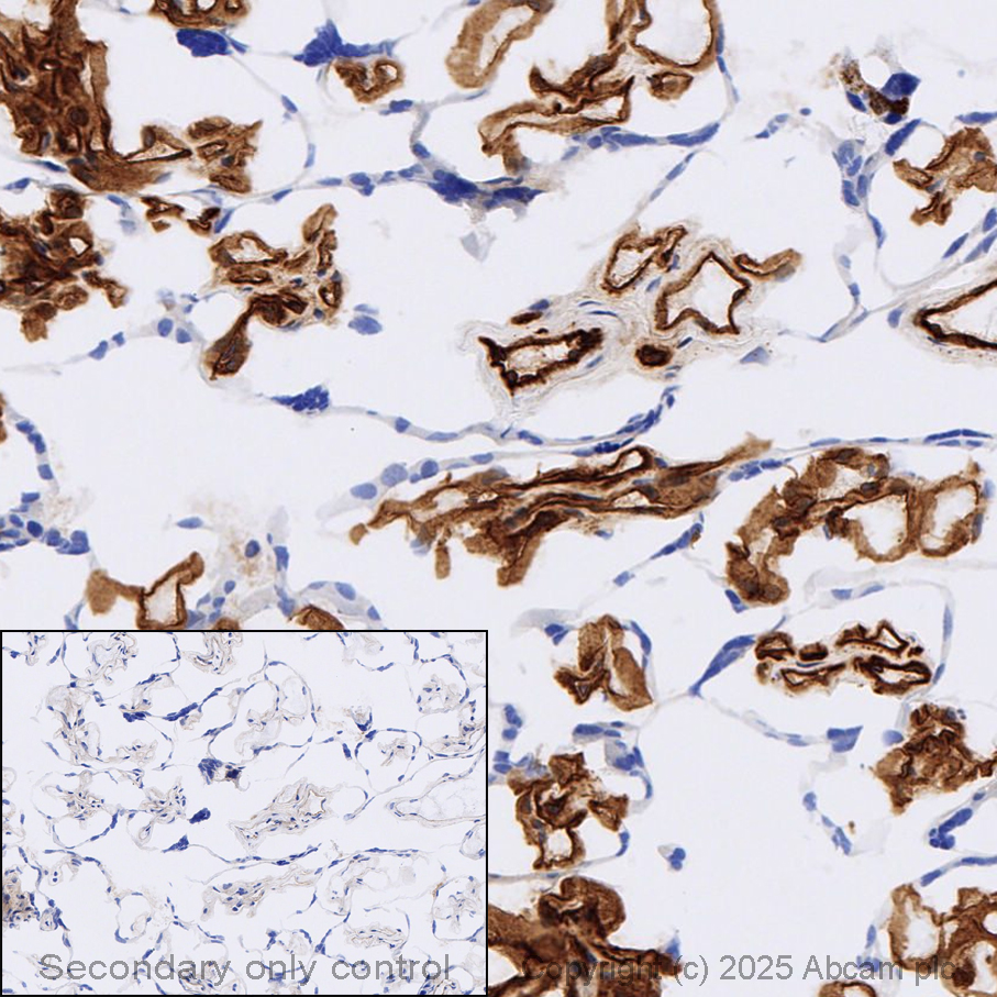 Anti-CD31 antibody [EPR17259] 20 ul size (ab182981) | Abcam
