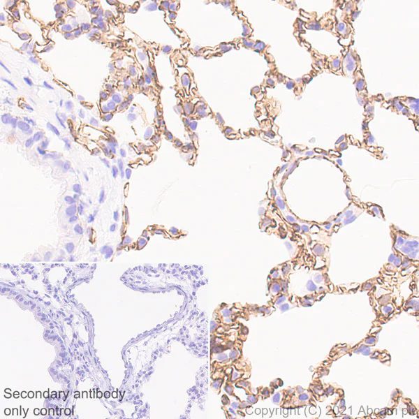 Anti-CD31 antibody [RM1006] 20 ul size (ab281583) | Abcam