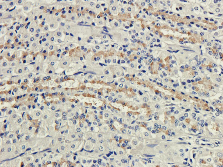 CD35抗体[8C12] (ab245683)| Abcam中文官网