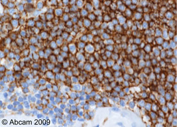 Anti-CD35 antibody [E11] - BSA free (ab25) | Abcam