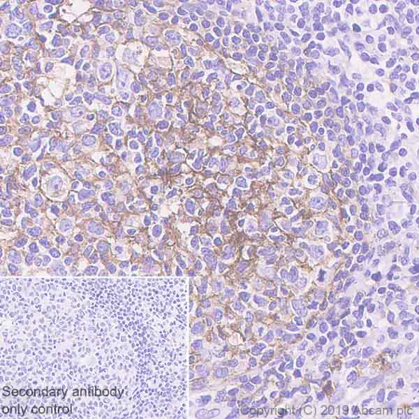 Anti-CD35 antibody [EPR6601] (ab133293) | Abcam