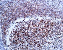 Anti-CD35 antibody [EPR6602] - BSA and Azide free (ab248156) | Abcam