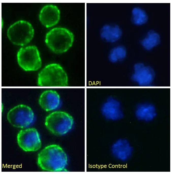 Anti-CD37 antibody [WR17] (ab245680) | Abcam