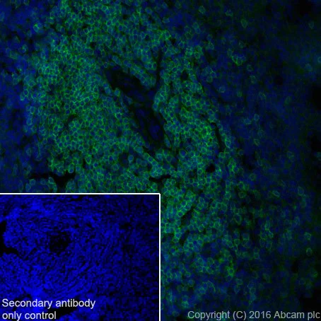 Anti-CD3D antibody [EPR20544] (ab213362) | Abcam