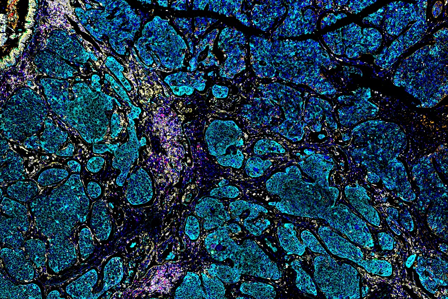 Anti-CD4 antibody [EPR6855] (ab133616) | Abcam