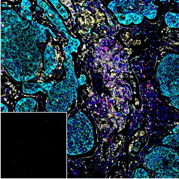 Anti-CD4 antibody [EPR6855] (ab133616) | Abcam