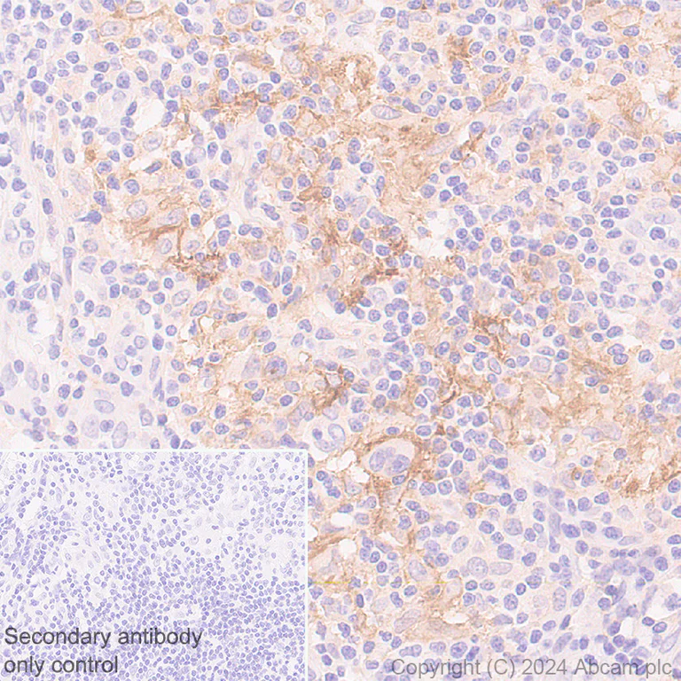 Anti-CD40 antibody [RM1193] (ab317586) | Abcam