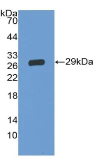 Anti-CD42d/GP5 antibody (ab233513) | Abcam