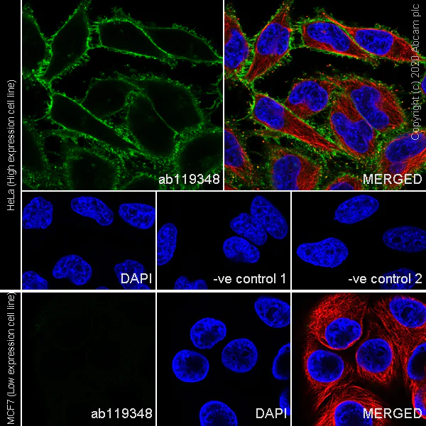 CD44抗体[1M7.8.1] (ab119348)| Abcam中文官网