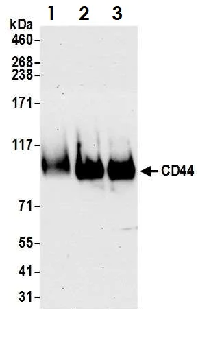 Anti-CD44 抗体 (ab157107) | Abcam