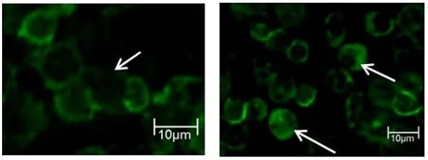 Anti-CD45 antibody [MEM-28], monocyte marker (ab8216) | Abcam