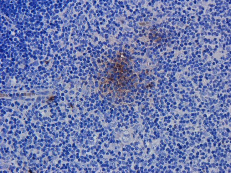 Anti-CD52 antibody [Campath-1H] (ab245681) | Abcam