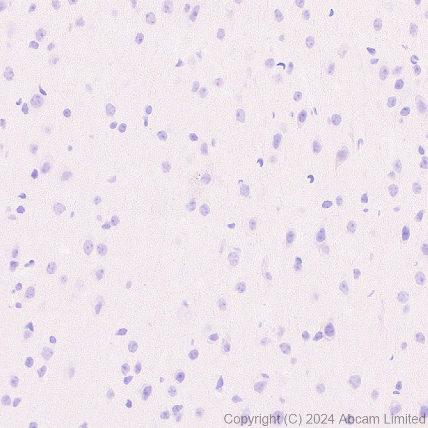 Anti-CD62E antibody [EPR28605-81] (ab319105) | Abcam