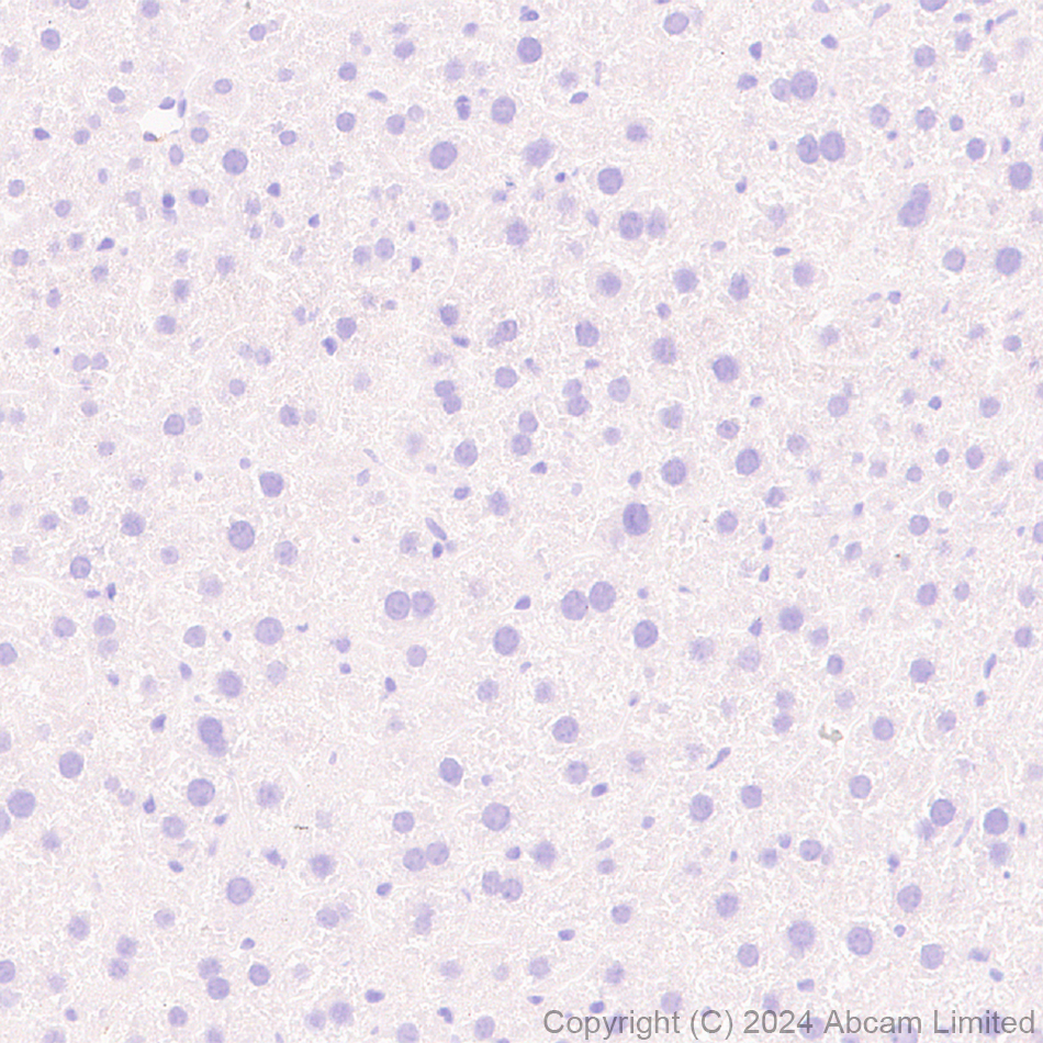 Anti-CD62E antibody [EPR28605-81] (ab319105) | Abcam