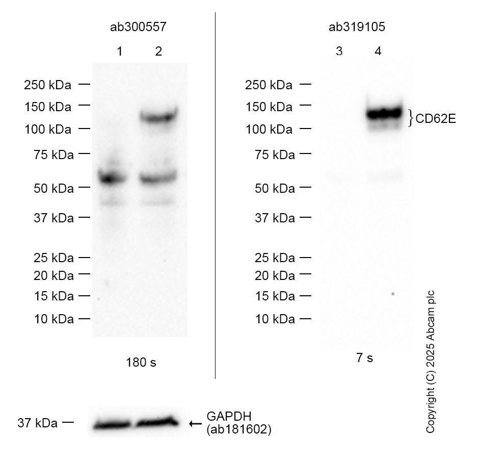 Anti-CD62E antibody [EPR28605-81] (ab319105) | Abcam