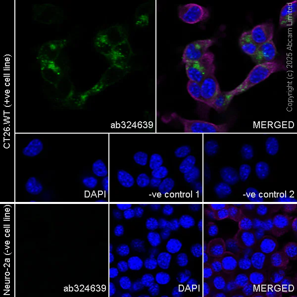 Anti-CD62E antibody [EPR29886-593] (ab324639) | Abcam