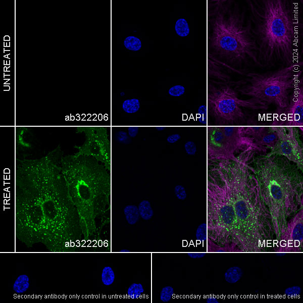 Anti-CD62E antibody [RM2070] (ab322206) | Abcam