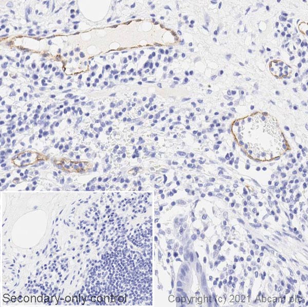 Anti-CD62P antibody [AK-6] Mouse monoclonal (ab6632) | Abcam