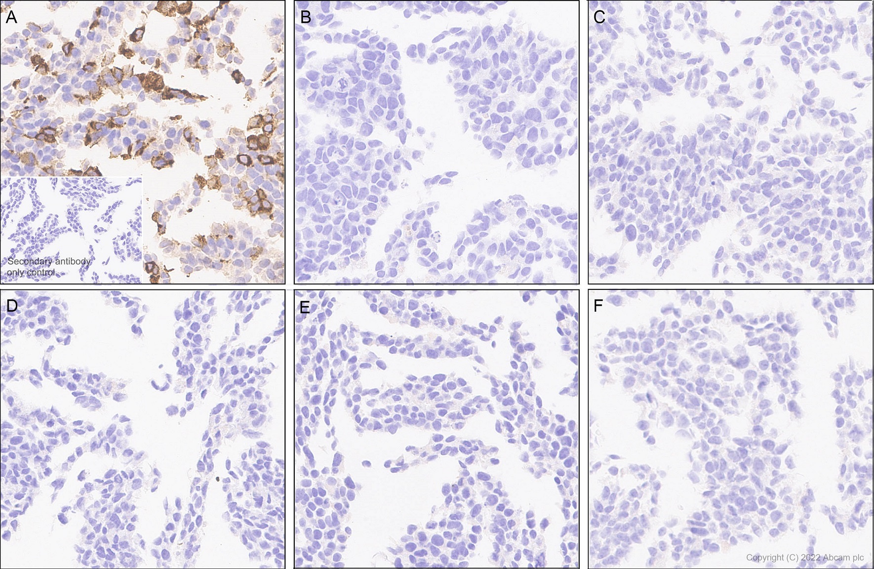 Anti-CD66b antibody [EPR25354-2] (ab300122) | Abcam