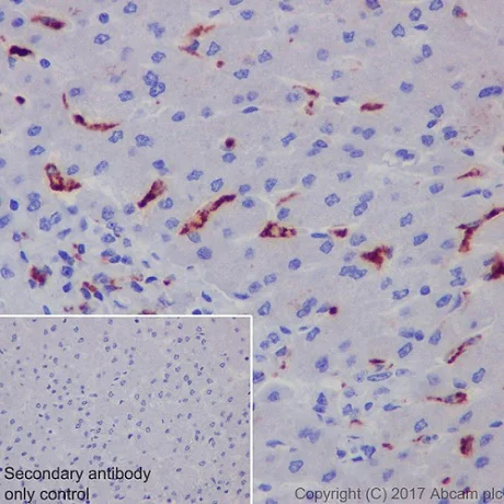 Anti-CD68 antibody [EPR20545] - macrophage marker (ab213363) | Abcam